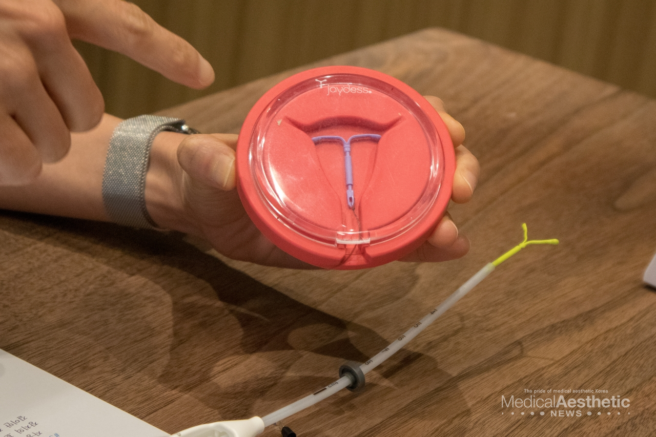 Advanced Contraception Methods; Hormonal IUD (Intrauterine Device ...