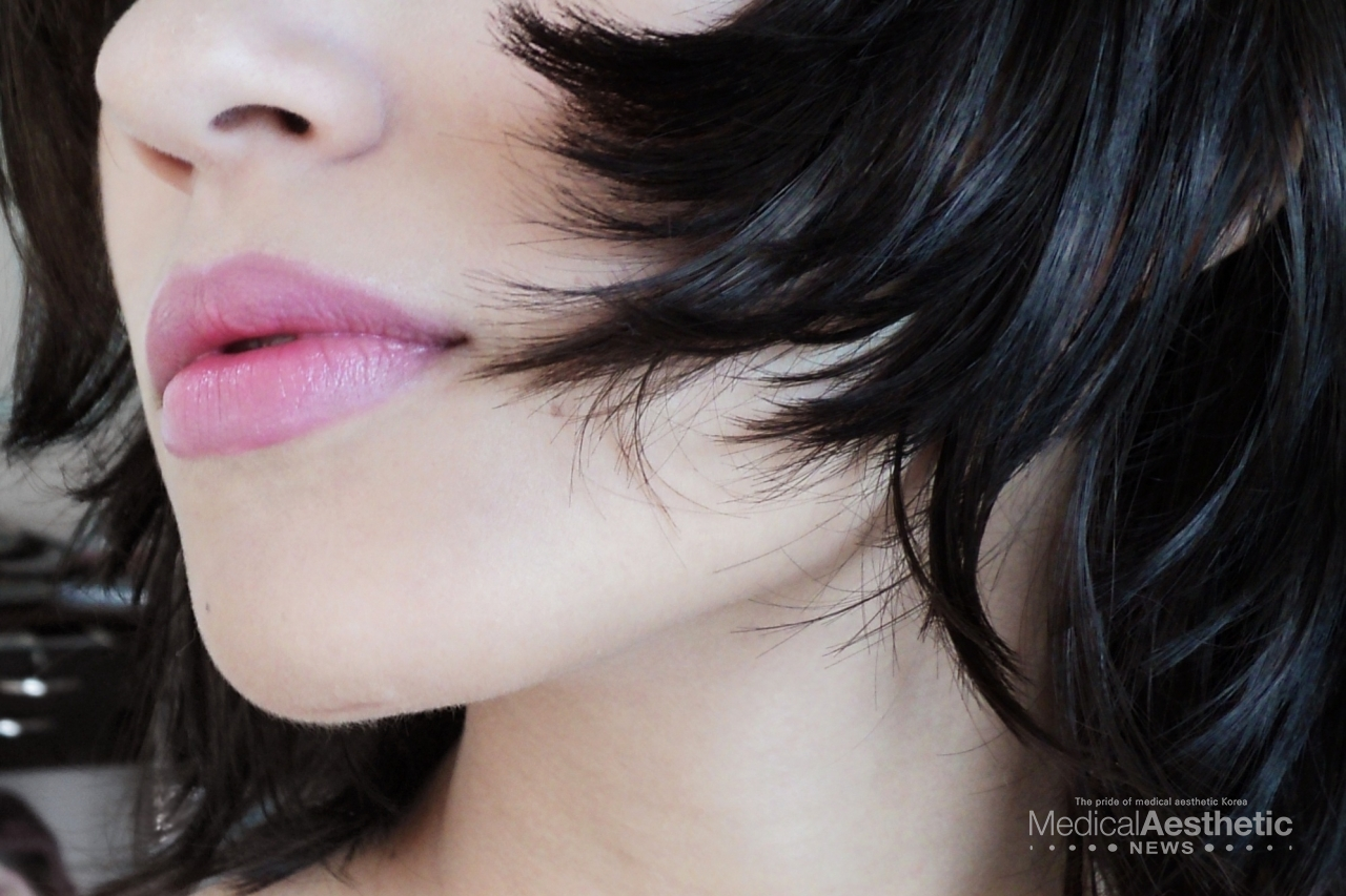 Square jaw surgery and treatment need to consider functional effects